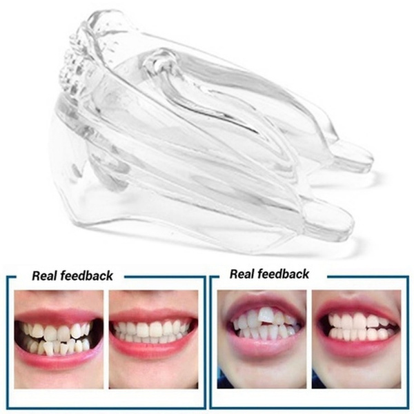 Professional Teeth Mouth Guard For Grinding Teeth Grinding New Beauty ...