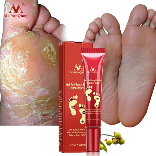 Herbal Effective Foot Cream Treatment Anti Fungal Infection ...