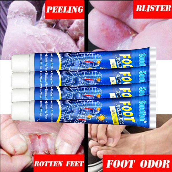 Herbal Effective Foot Cream Treatment Anti Fungal Infection ...