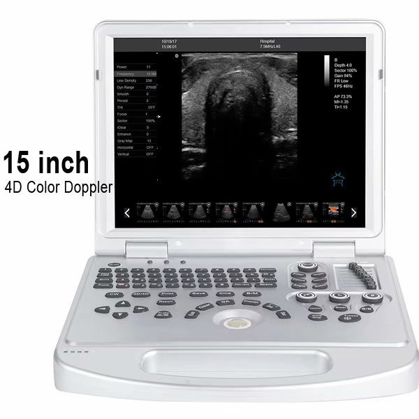 Portable Laptop 15 inch LED Screen 4D Color Doppler Ultrasound Scanner ...