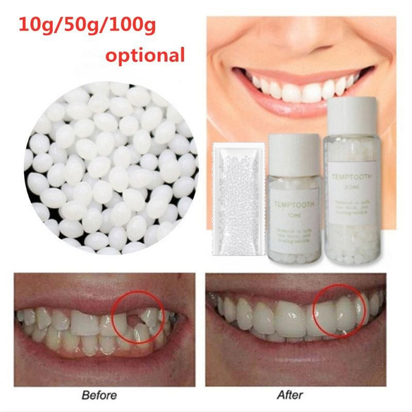 Temporary missing dental prosthetic kit teeth notch false teeth solid ...