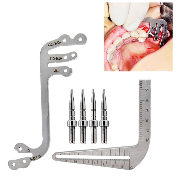 Dental Implant Surgery Instrument Oral Planting Positioning Guide ...