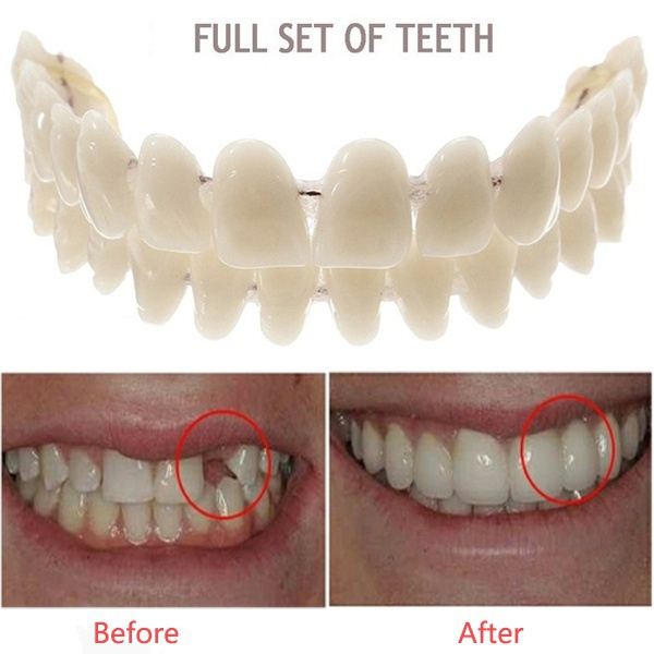 28pcs Professional Preformed Dentition Oral Dentist Resin Teeth Model ...
