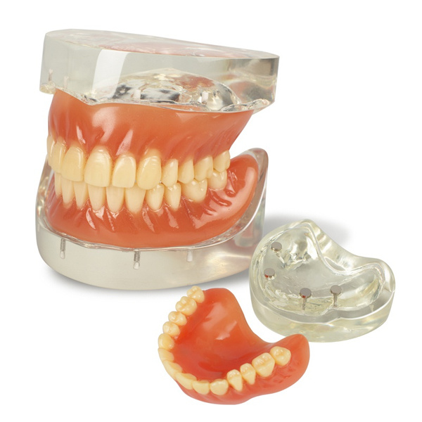 Dental Teach Study Adult Standard Demonstration Model Teeth | Wish Dental Teach Study Adult Standard Demonstration Model Teeth | Wish