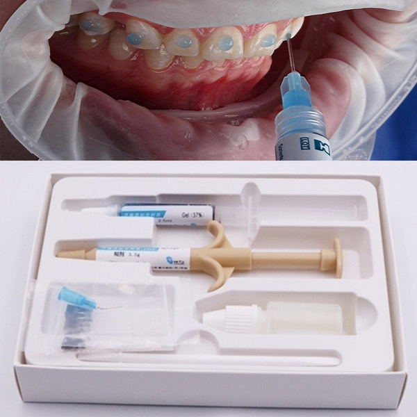 New Dental Orthodontic Direct Paste Adhesive Bonding Self Curing ...
