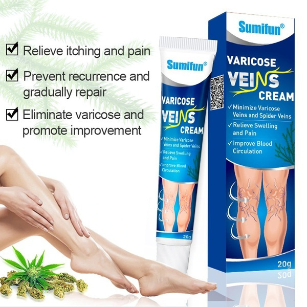 20g Vasculitis Phlebitis Spider Legs Treatment Ointment Varicose Veins ...