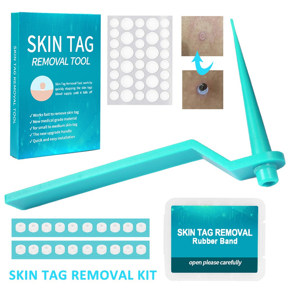 Skin Tag Remover Device Safe and Painless Skin Tag Removal Kit with ...