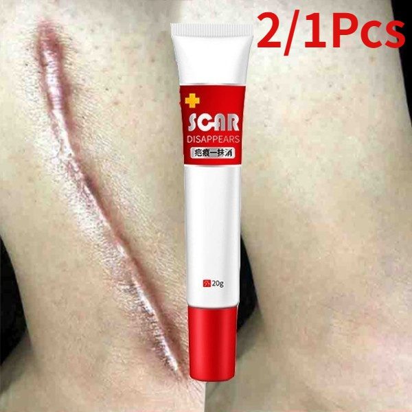 New / 20g Acne Scar Removal Cream Skin Repair Face Cream Acne Spots ...