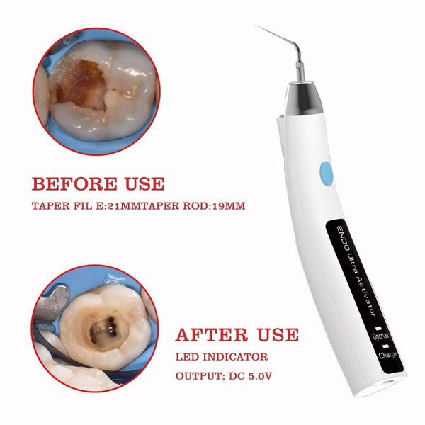 Dentistry Dental Endodontic Ultrasonic Activator Cordless LED Light ...