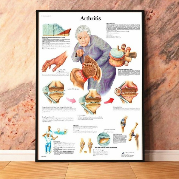Anatomy Diseases Pathology Chart Canvas Painting Body Map Posters Wall ...