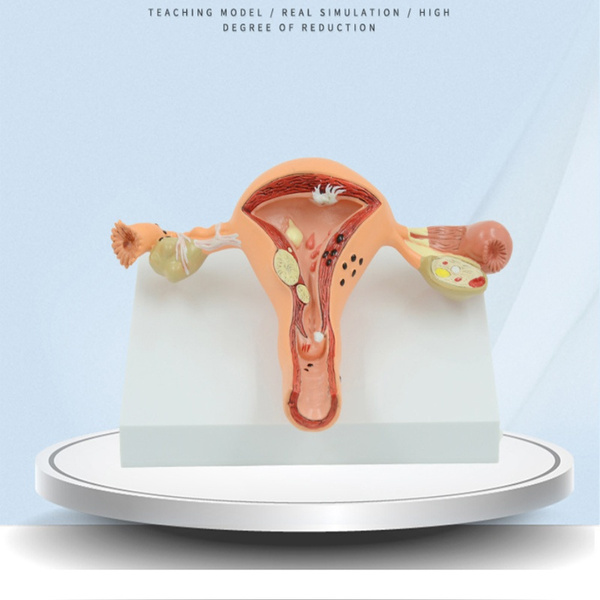 Female Pathological Uterus Ovary Anatomical Model Anatomy Cross-Section ... Female Pathological Uterus Ovary Anatomical Model Anatomy Cross-Section ...
