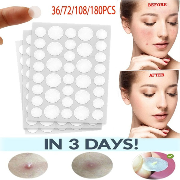Skin Moles Acne Removal Patch Pimple Remover Tool Blemish Spot Skin ...