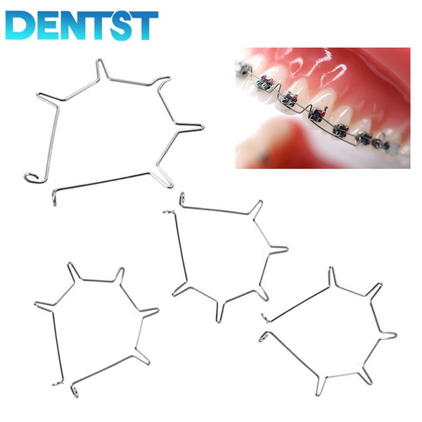 5pcs/Bag Dental Anterior Auxiliary Torquing Spring Arch Small Middle ...