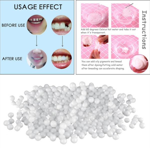 NEW Temporary Tooth Repair Kit Thermal Molding Repair Fitting Bead ...