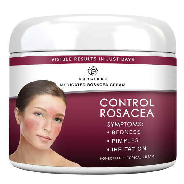 10/20/30/50g Redness Relief Face Cream All-Natural Anti Itch Cream Fast ...