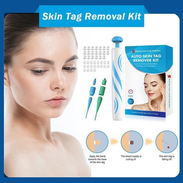 2 In 1 Auto Wart Spot Mole Home Use Cauterizer Effective Painless Skin ...