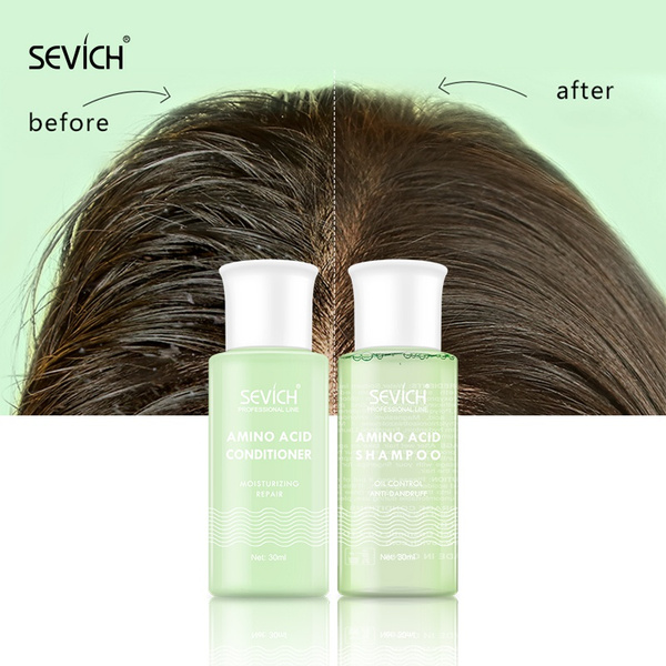 Sevich Amino Acid Shampoo And Conditioner Set Oil Control Scalp Anti ...