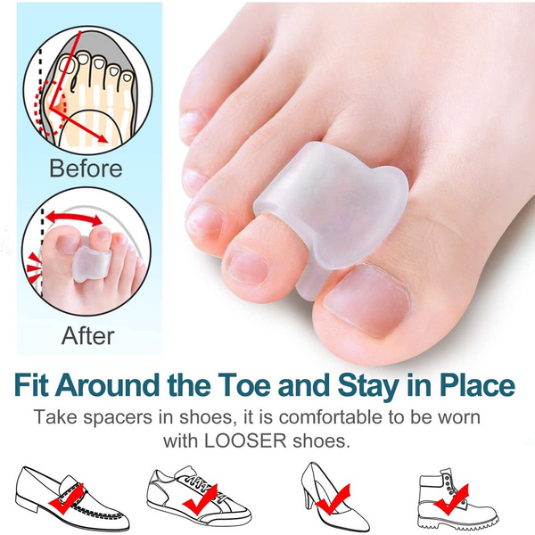 Big toe separator, thumb bursitis corrector | Wish