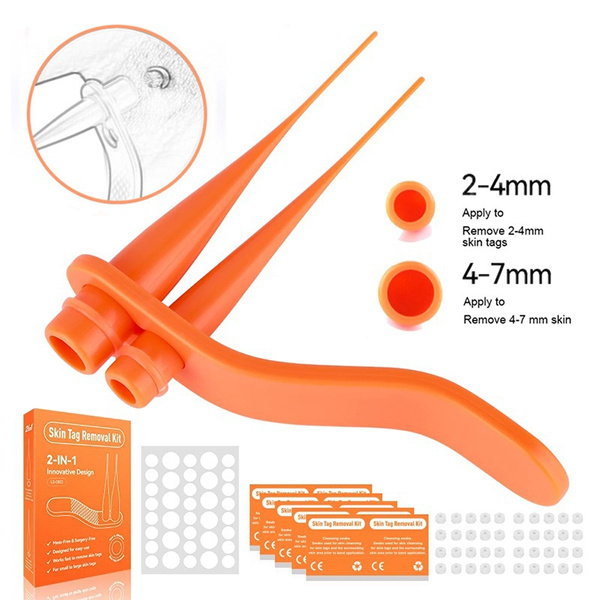 2 In 1 Fast Effective Mole For 2-7mm Skin Tag Wart Portable Painless ... 2 In 1 Fast Effective Mole For 2-7mm Skin Tag Wart Portable Painless ...