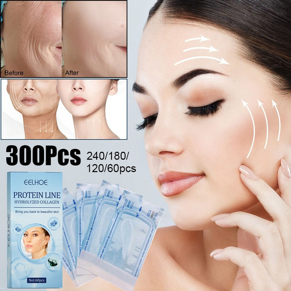 60/120/180/240/300Pcs Absorbable Anti-Wrinkle Face Filler Beauty ...