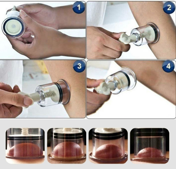 5 Size Medical Portable Twist Suction Vacuum Magnet Massage Cupping ...