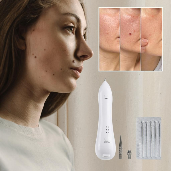 Electric Mole Removal Pen, Electric Cautery Wart, Mole, Speckle, Skin ...