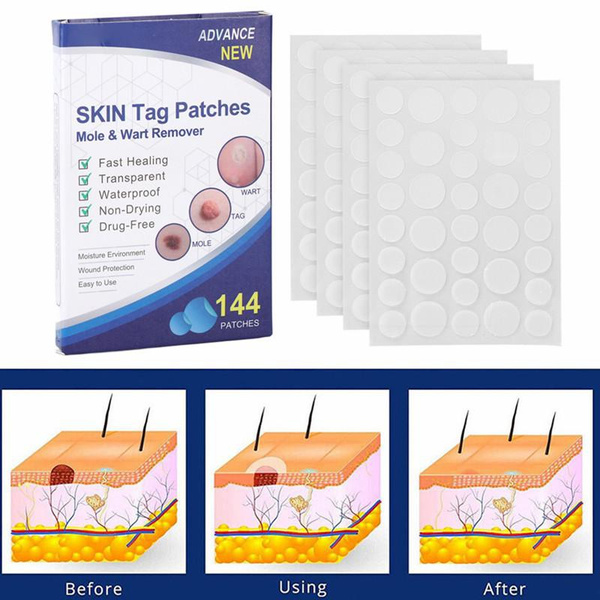 144pcs Wart Remover Natural For Face Body Healing Skin Tag Patch | Wish