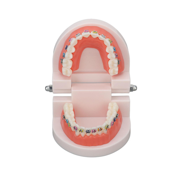 Dental Typodont Teeth Model with Orthodontic Metal Bracket for Dentist ...