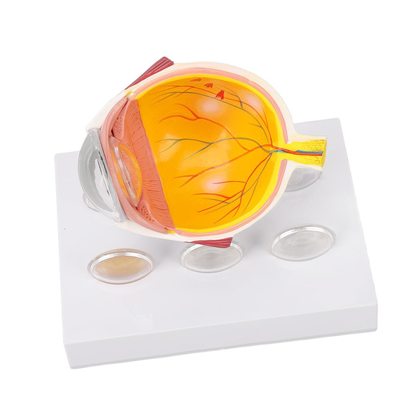 Eye Model, Enlarged Human Eye Anatomical Model, Eyeball Model Including ... Eye Model, Enlarged Human Eye Anatomical Model, Eyeball Model Including ...