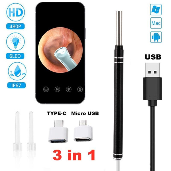 3 in 1 Ear Otoscope Camera Lighting Control Safely Ears Cleaning for ...